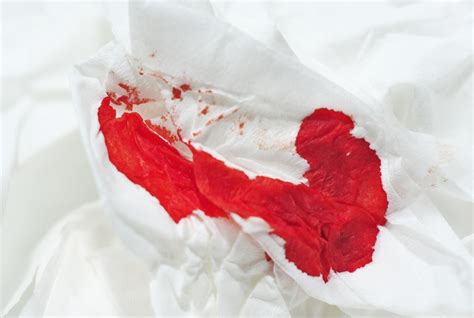 Image result for Red Poop Beets