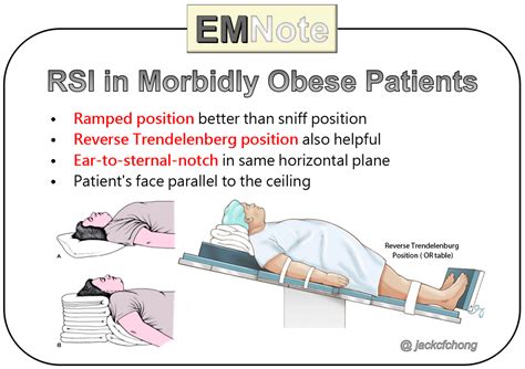 Image result for Intubation Position
