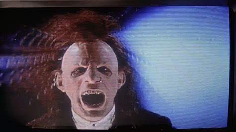 Image result for Brain Scan Bruce Perry