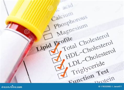 Image result for Lipid Profile Testing