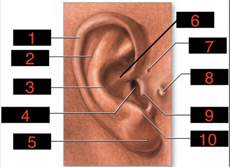 Image result for Outer Ear Angiogram