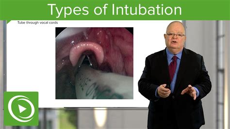 Image result for Types of Intubation