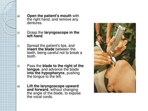 Image result for Intubation Steps