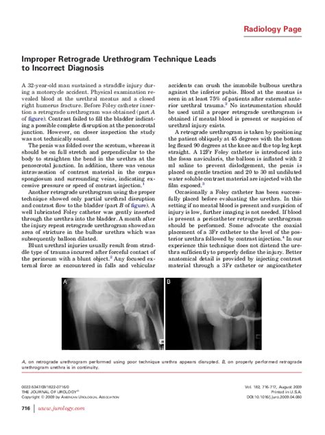 Image result for Urethrogram Technique