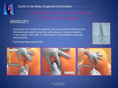 Image result for Urogram Exam