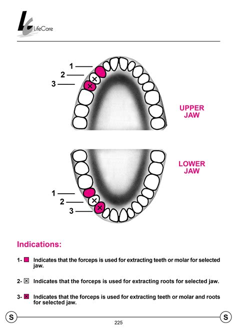 Image result for Extracting Forceps