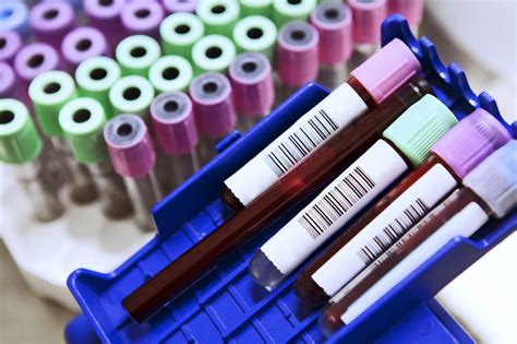 Image result for Birth Control Exam