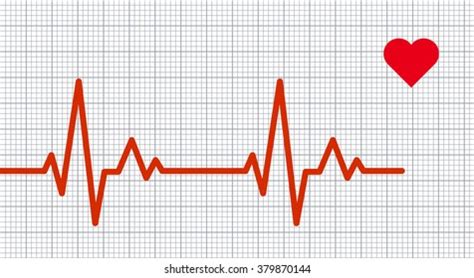 Image result for Normal EcG