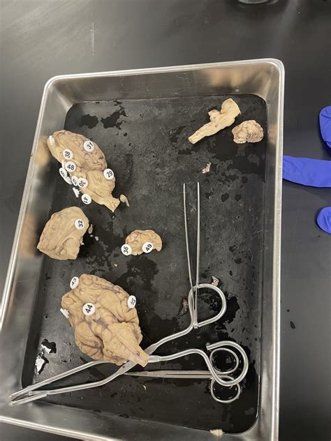 Image result for Brain Dissection