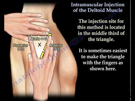 Image result for Intramuscular Injection