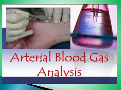 Image result for ABG Testing Machine Southeastern Trust