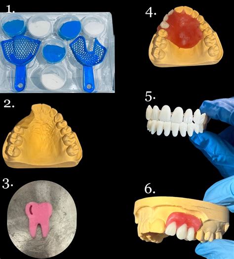 Image result for DIY Tooth Bridge Kit