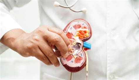 Image result for Urogram Exam