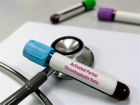 Image result for Apr Tube Testing