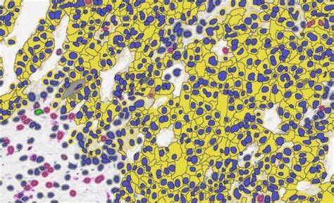 Image result for Multiplex IHC Kit