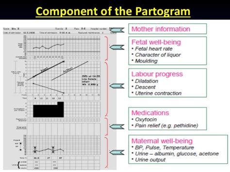 Image result for Types of Partograph