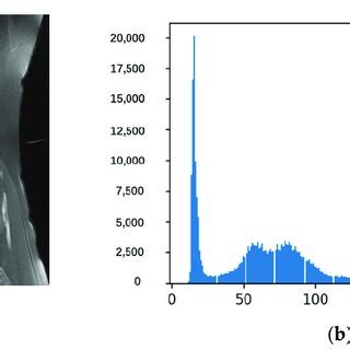 Image result for Frequency Distribution Histogram