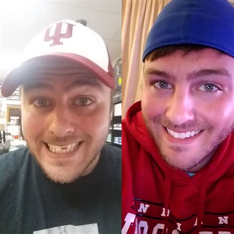 Image result for Temptooth Repair Instructions