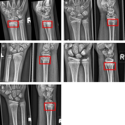 Image result for Image Processing Algorithm for DICOM Images