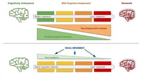 Image result for Visuospatial Dysfunction