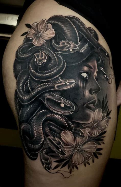 Image result for AVM Recovery