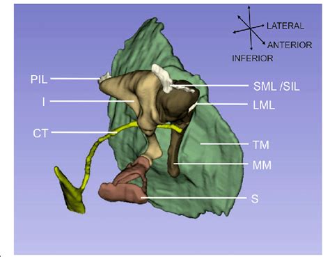Image result for Incus On-Ear Model