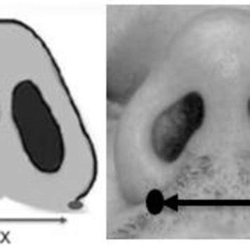 Image result for Alar Guide