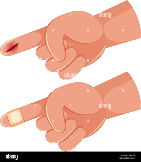 Image result for Cut Finger Tutorial