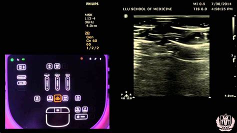 Image result for Ultrasound Machine How It Works