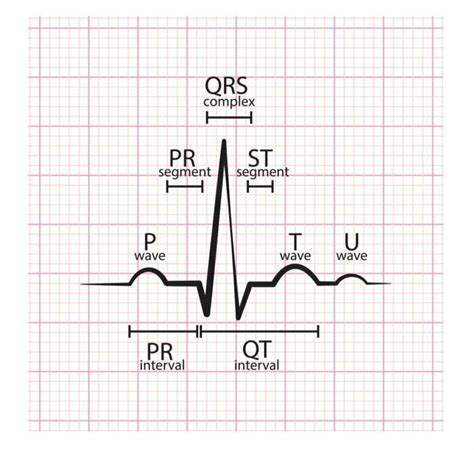 Image result for Paediatric PR Interval