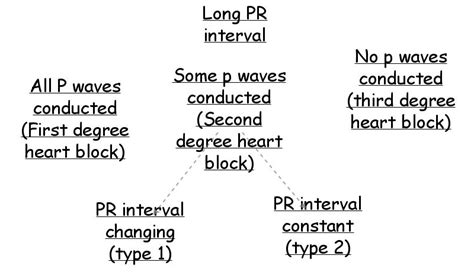 ECG: Long PR interval | Insight Maker