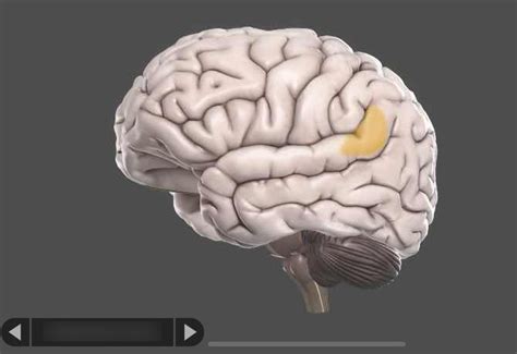 Image result for The Function of the Wernicke Connection