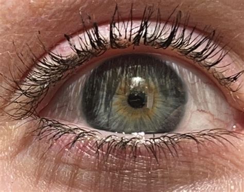 Image result for Eye Color Check