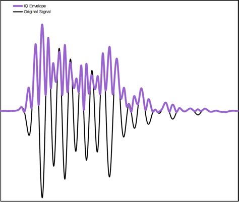 Image result for Linear Array Ultrasound Signal Processing Diagram