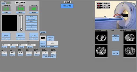 Image result for Urogram 3 Phase CT