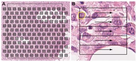 Image result for Systematic Random Grid Sampling