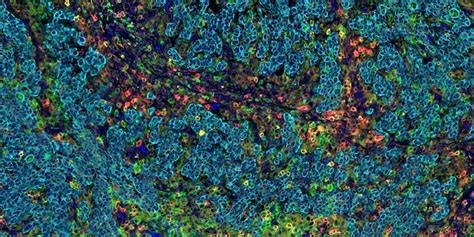 Image result for Multiplex IHC Protocol