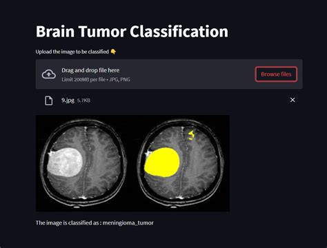 Image result for Brain Tumor Classification Problem Statement