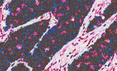 Image result for Multiplex IHC