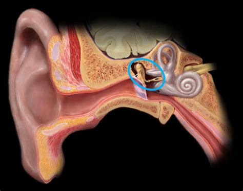 Image result for Incus On-Ear Model
