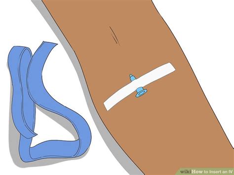 Image result for Insert IV Line