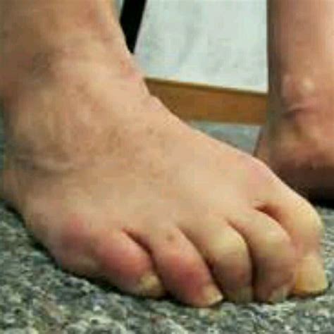 Image result for Toe Curls Exercise