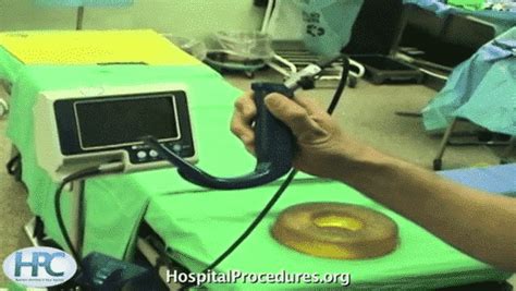 Image result for GlideScope Intubation