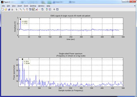 Image result for MATLAB EMG Filter