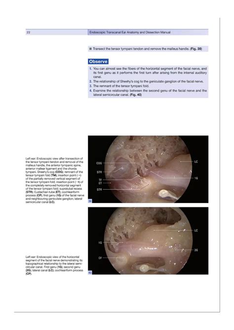 Image result for Ear Dissection