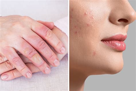 Image result for What Else Can Toothpaste Be Used For