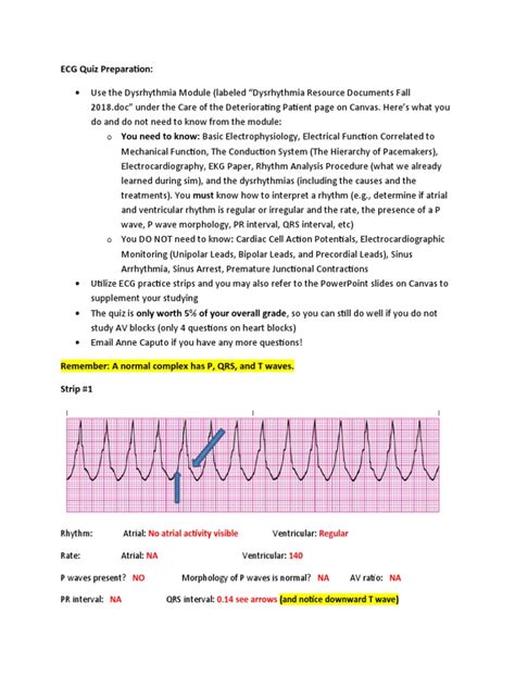 Image result for ECG Reading Practice