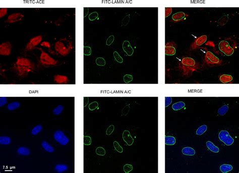Image result for Nuclear Envelope Localization