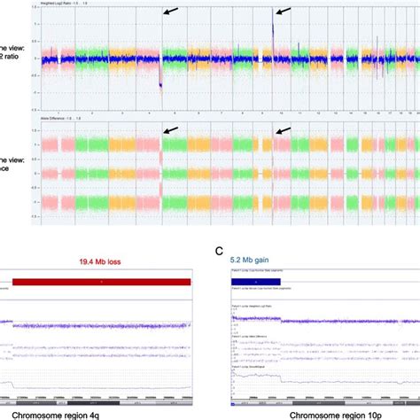 Image result for Chromosomal Microarray Procedure
