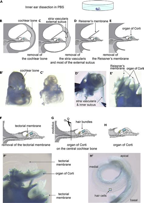 Image result for Ear Dissection